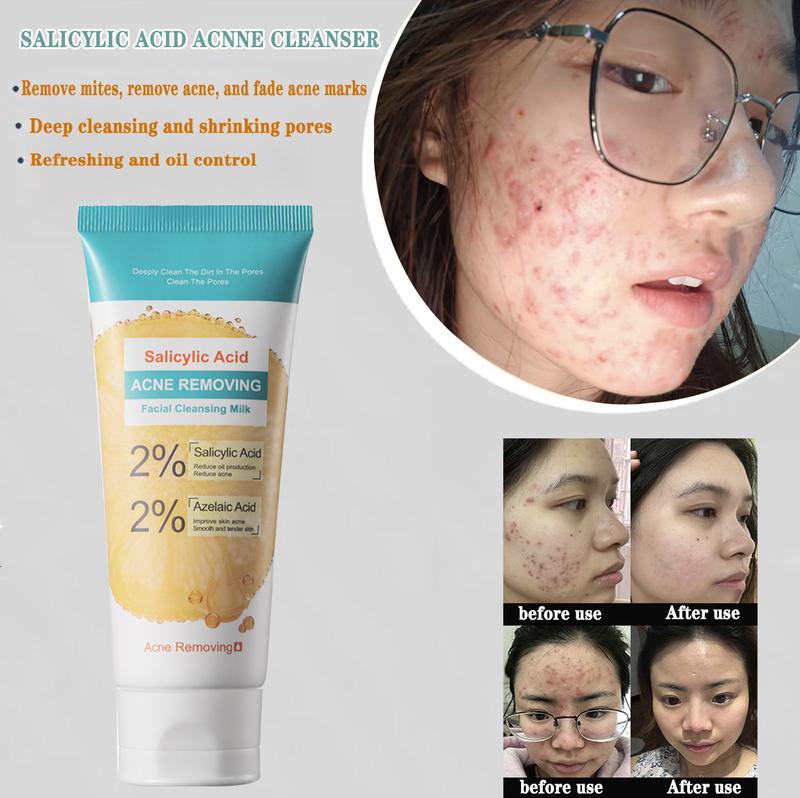 查看[Salicylic acid anti-acne cleanser removes blackheads, shrinks pores ...