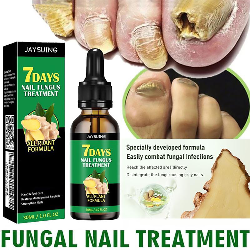 7-Day Nail Fungus Treatment-Soften Thick Nails, Whiten Discolored Nails ...