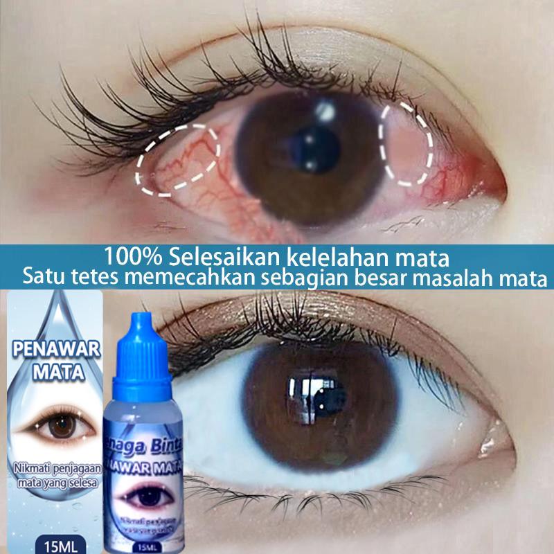 Penawar Mata Homeopathy 15ml, Eye Drop Water Alami TikTok爆款商品分析 - GMV ...