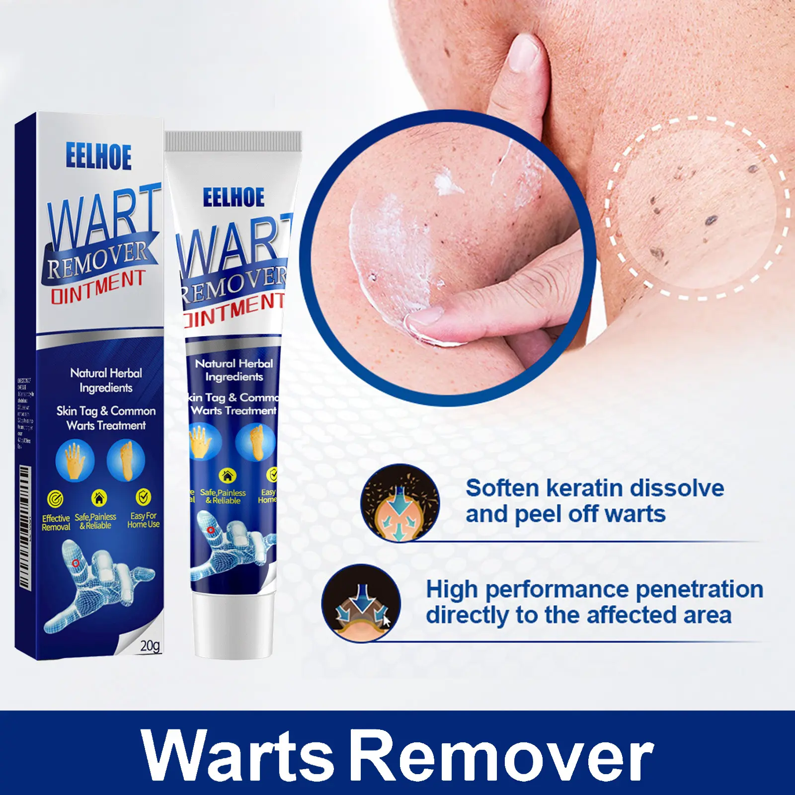 查看[EELHOE corn wart,Wart Cream Acting Gel Wart Remover]在TikTok的销量数据表现 ...