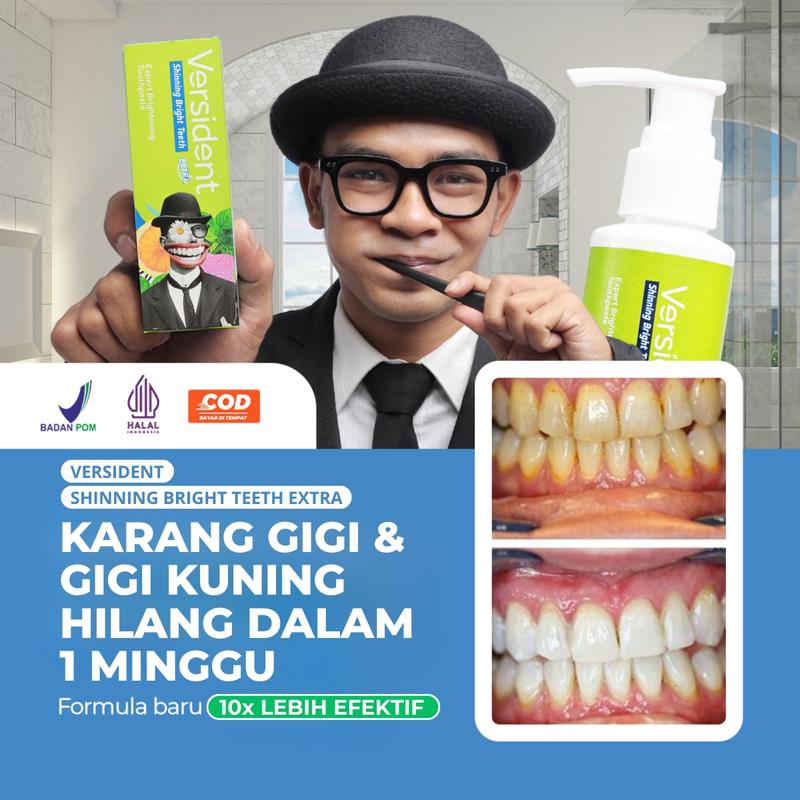 [PROMO LIVE] VERSIDENT Pasta pemutih gigi, Pemutih TikTok爆款商品分析 - GMV ...