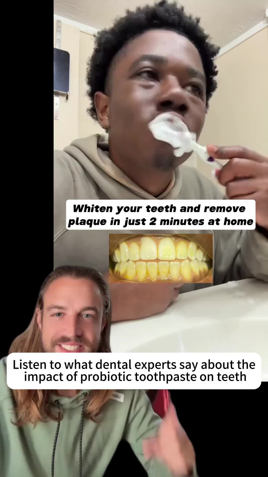 White your #teeth and remobe plaque in just 2 minutes at home # ...