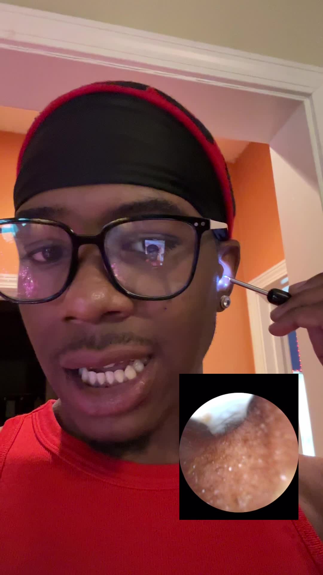 A good ole ear scratch 😂#fyp #earwaxremoval #satisfying #virall 丨TikTok ...