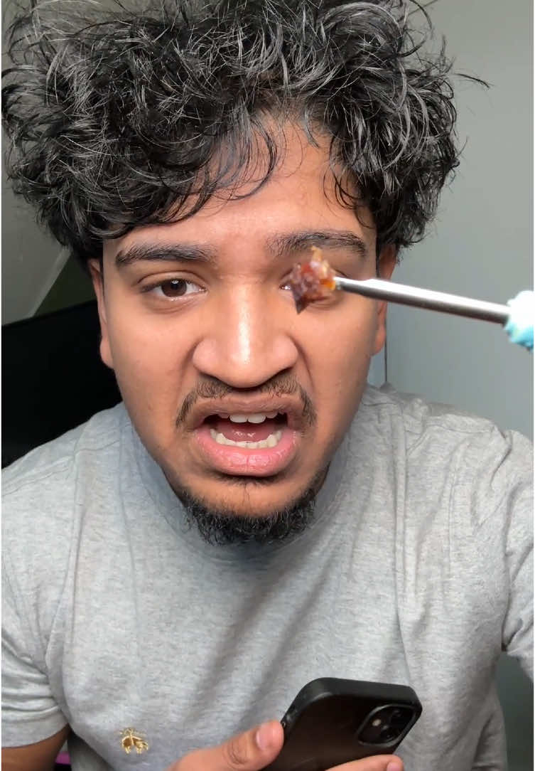 This was kinda cool, ear wax tool real review 丨TikTok Shop Sales ...