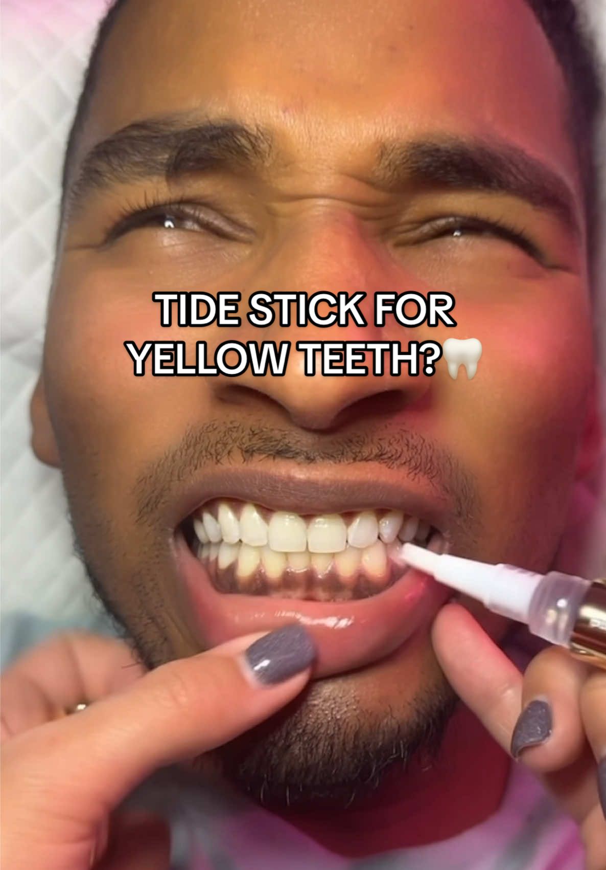 Basically a tide stick for your teeth, genius #teethwhitening # ...