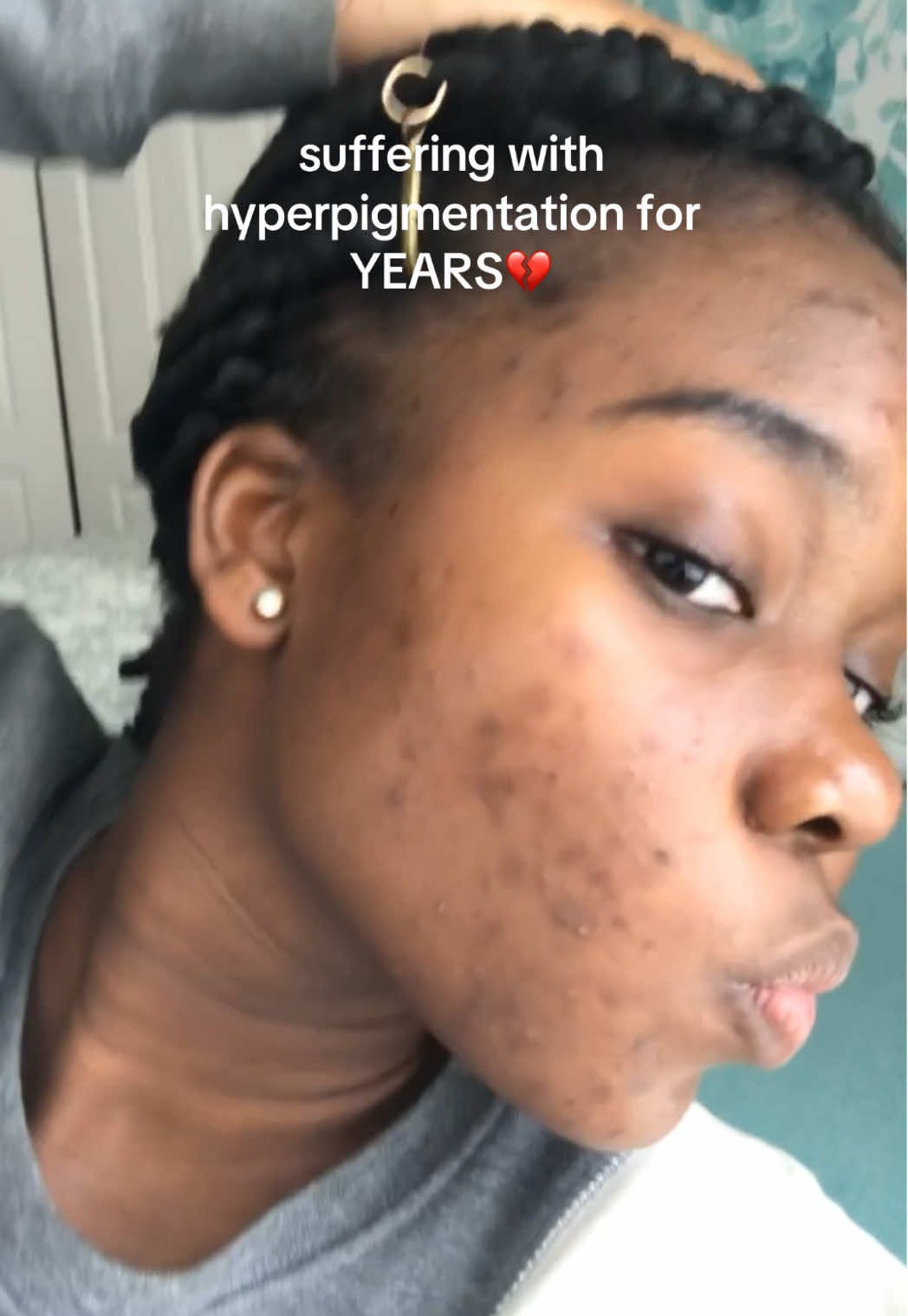 literally got stopped and at the store and asked ab my skincare routine ...